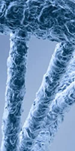 Comparison of Chimp Contigs to Human Genome via BLASTN | ARJ